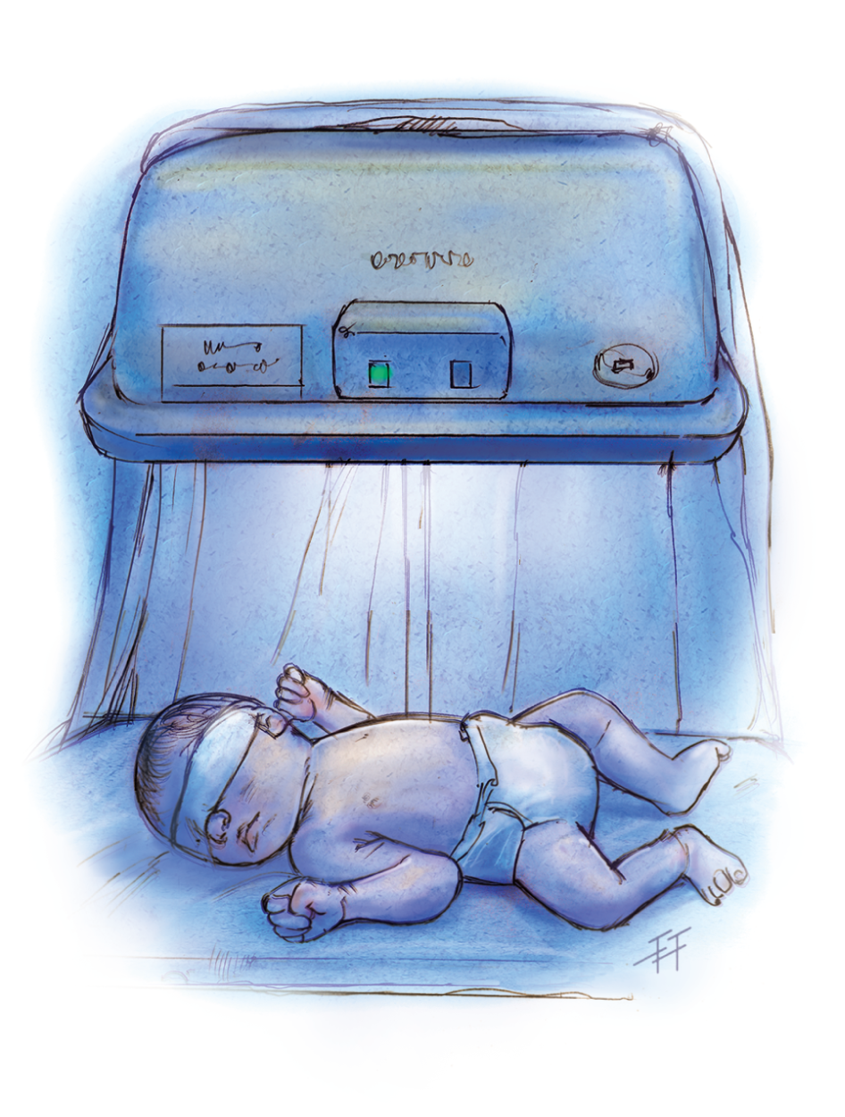 neonataljaundice – Virtue TCM 醫道閣